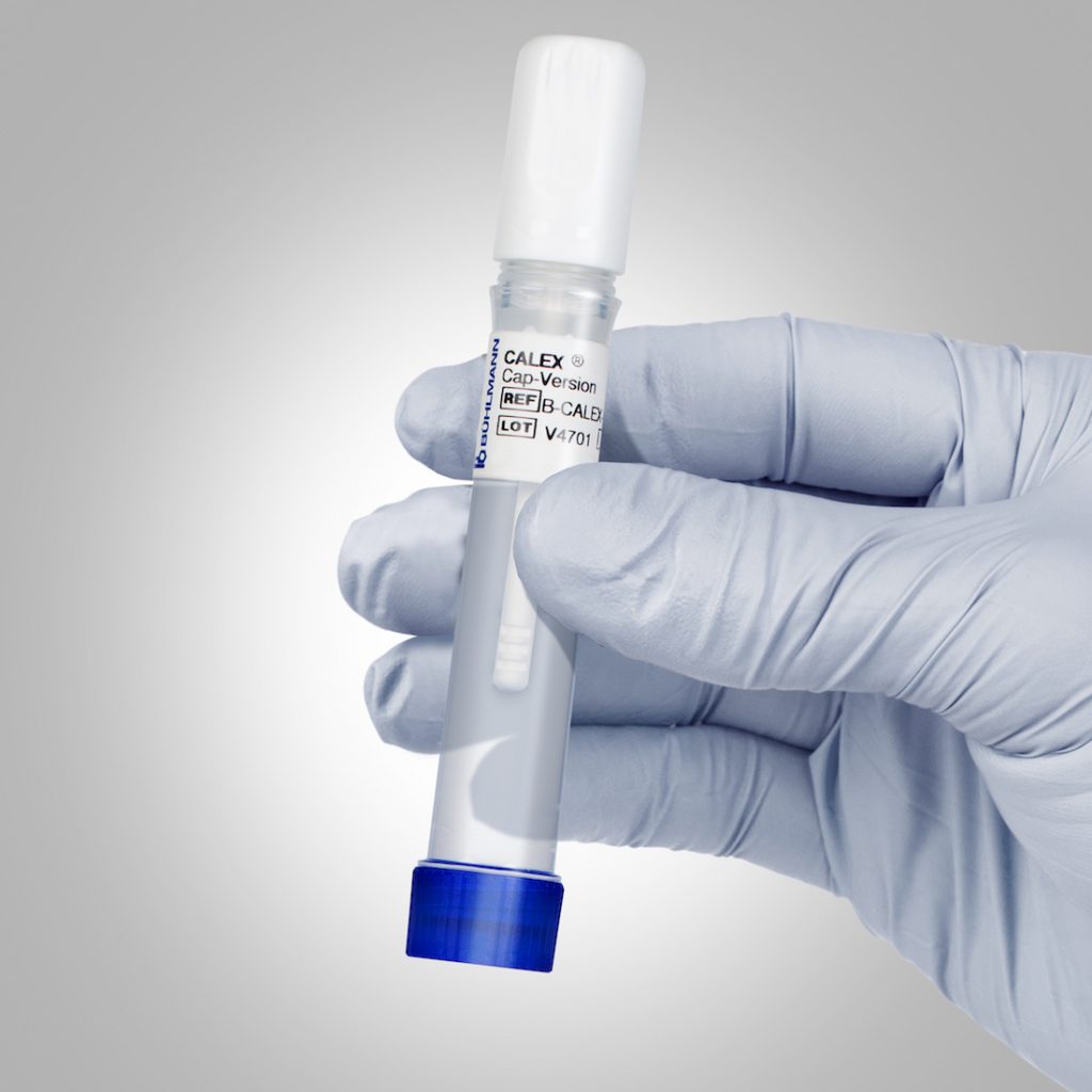 Calprotectin Assays | Calprotectin Extraction Methods | Extraction